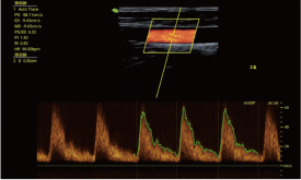 Auto Doppler Trace - Ultrana Medical