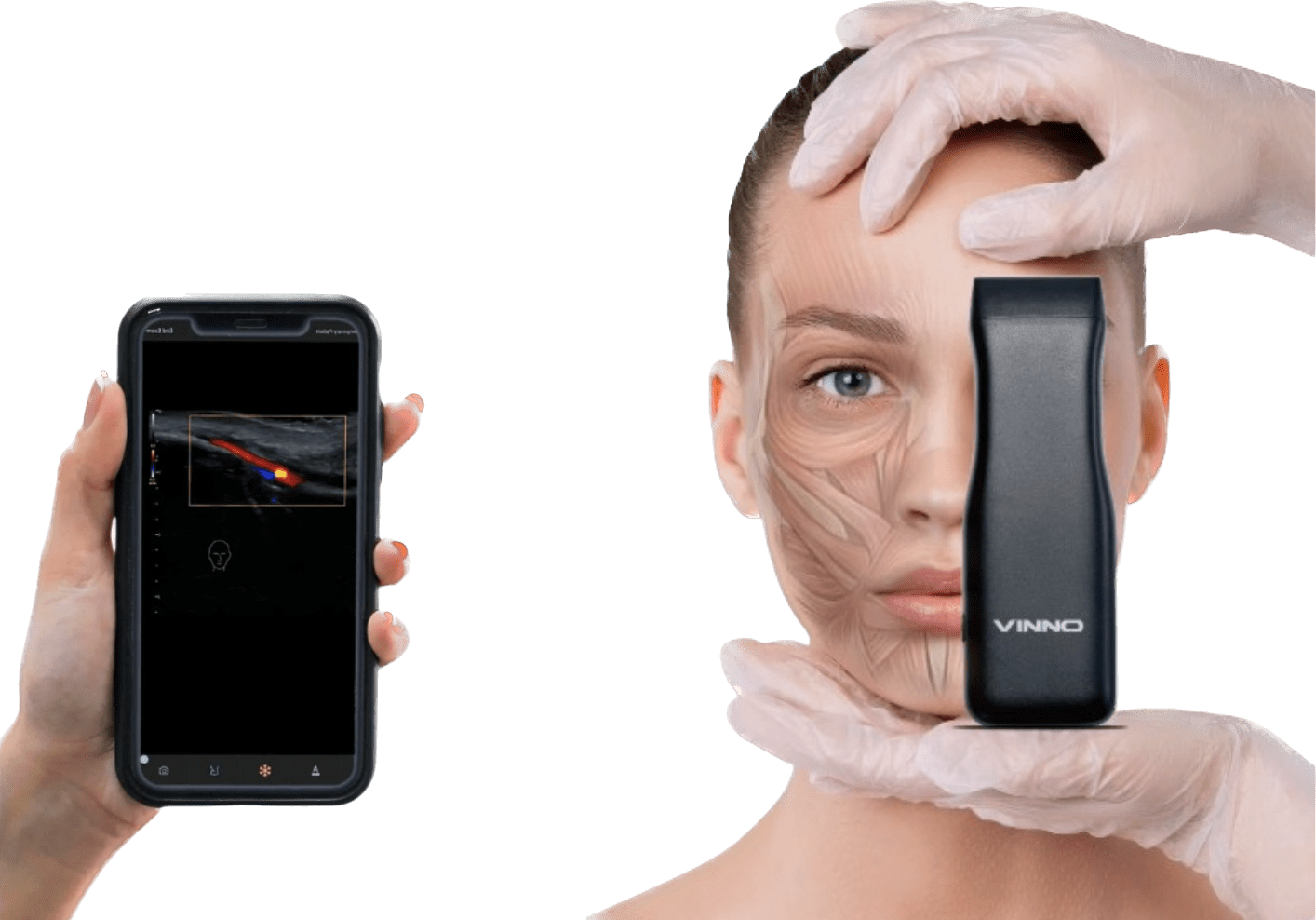 Physio Ultrasound Machine - Portable Aesthetics Device