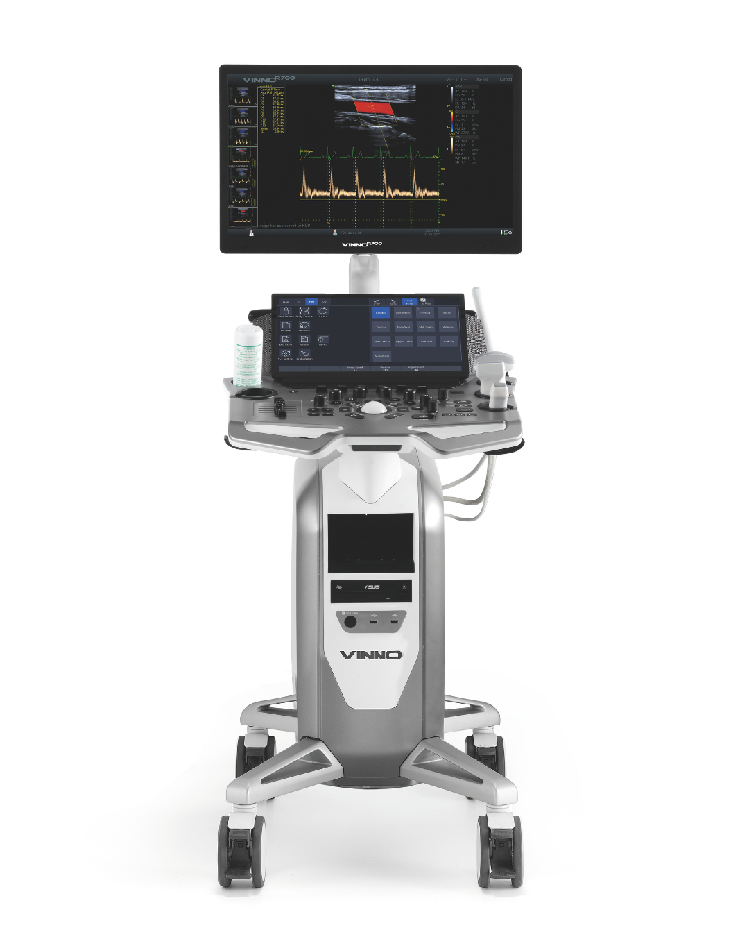 Cart-based Ultrasound - Ultrana Medical